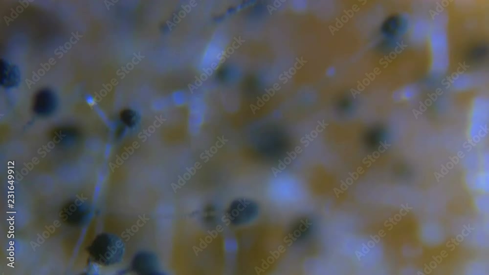 Black Mold taken from rotten bread , under a microscope. Colony of mold with spores on a bread ...