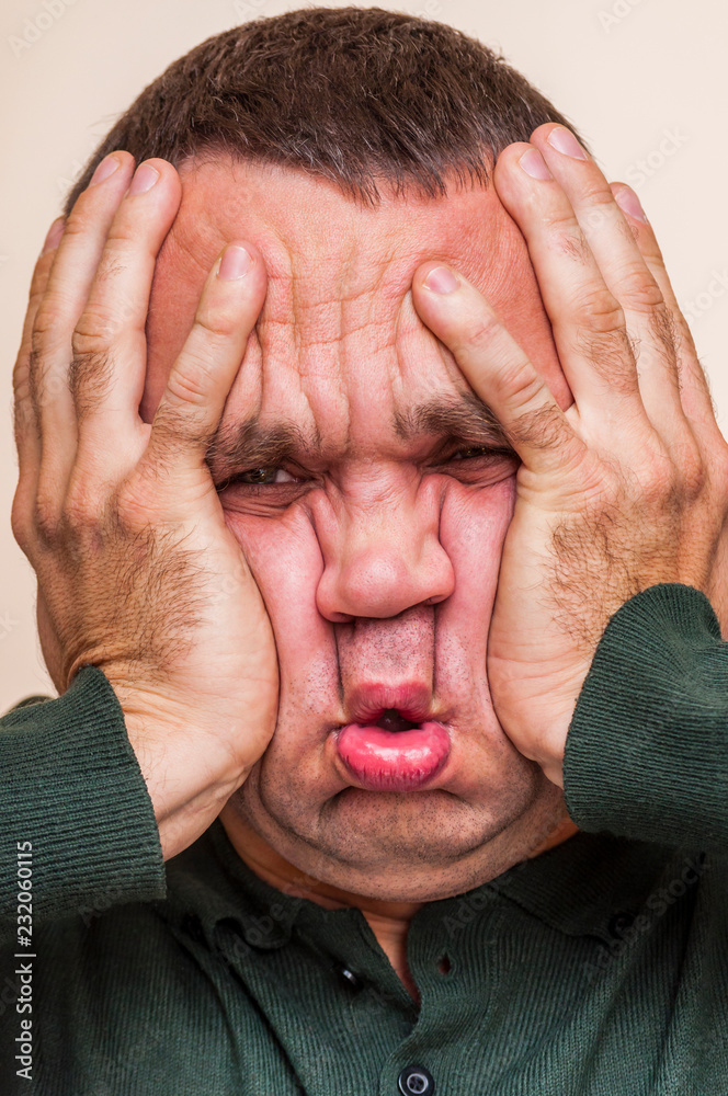 Stressed, shocked man squeezing his depressed face with palms. Stock ...