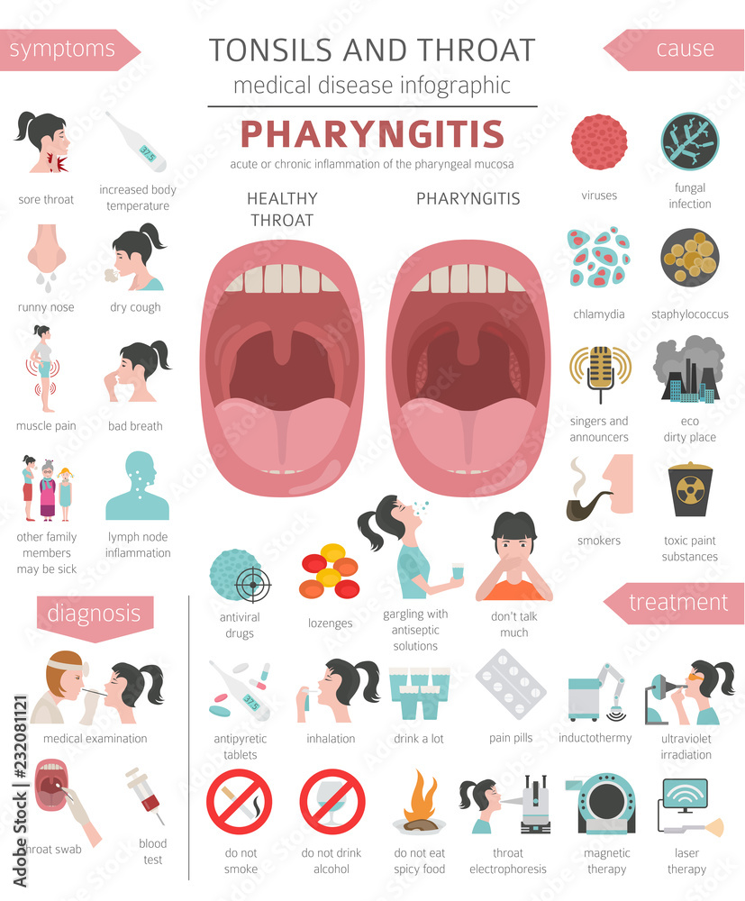 Tonsils and throat diseases. Pharyngitis symptoms, treatment icon set ...