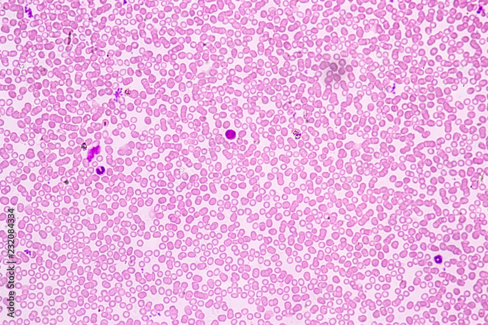 Study of white blood cells are the cells of the immune system under the ...