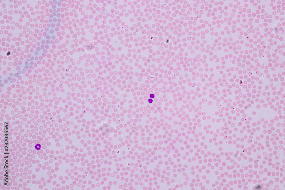 Study of white blood cells are the cells of the immune system under the ...