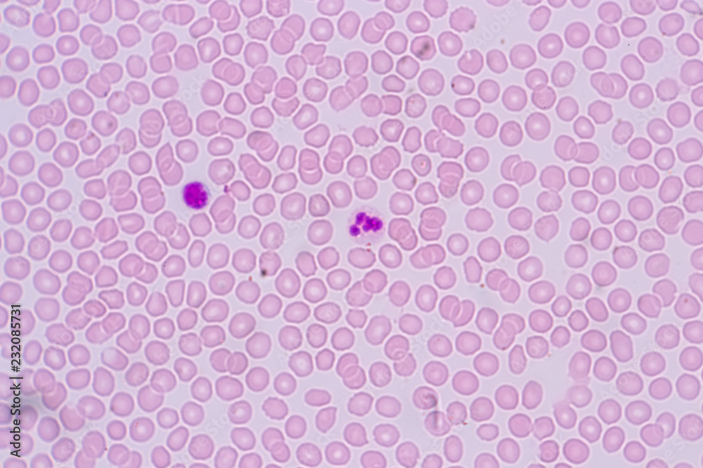 Study of white blood cells are the cells of the immune system under the ...