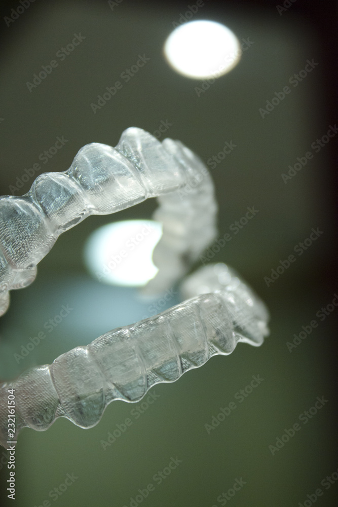 Transparent dental orthodontics to correct dental alignment Stock Photo ...