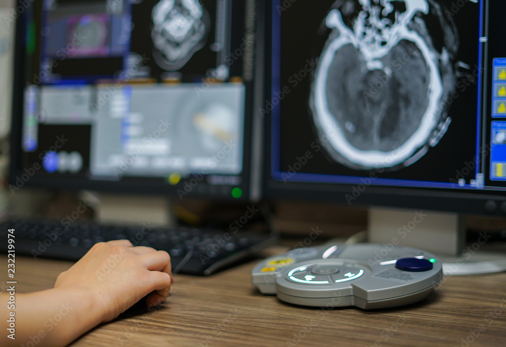 Radiotechnologist hand holding mouse while working on CT scan ...