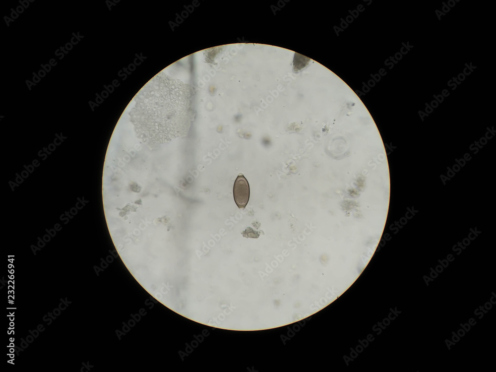 Trichuris trichiura egg under 40X microscope Stock Photo | Adobe Stock