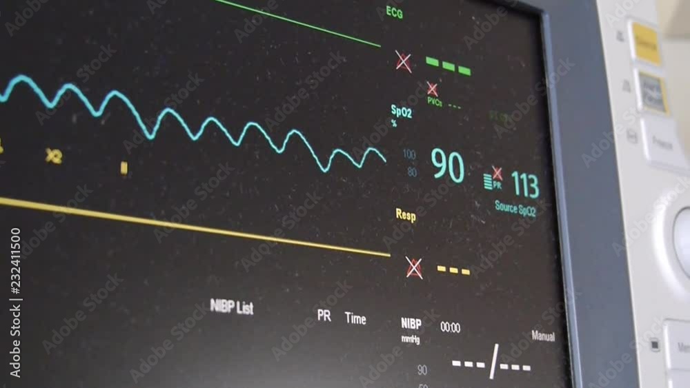 Close-up view of the screen of a vital sign monitor displaying low ...