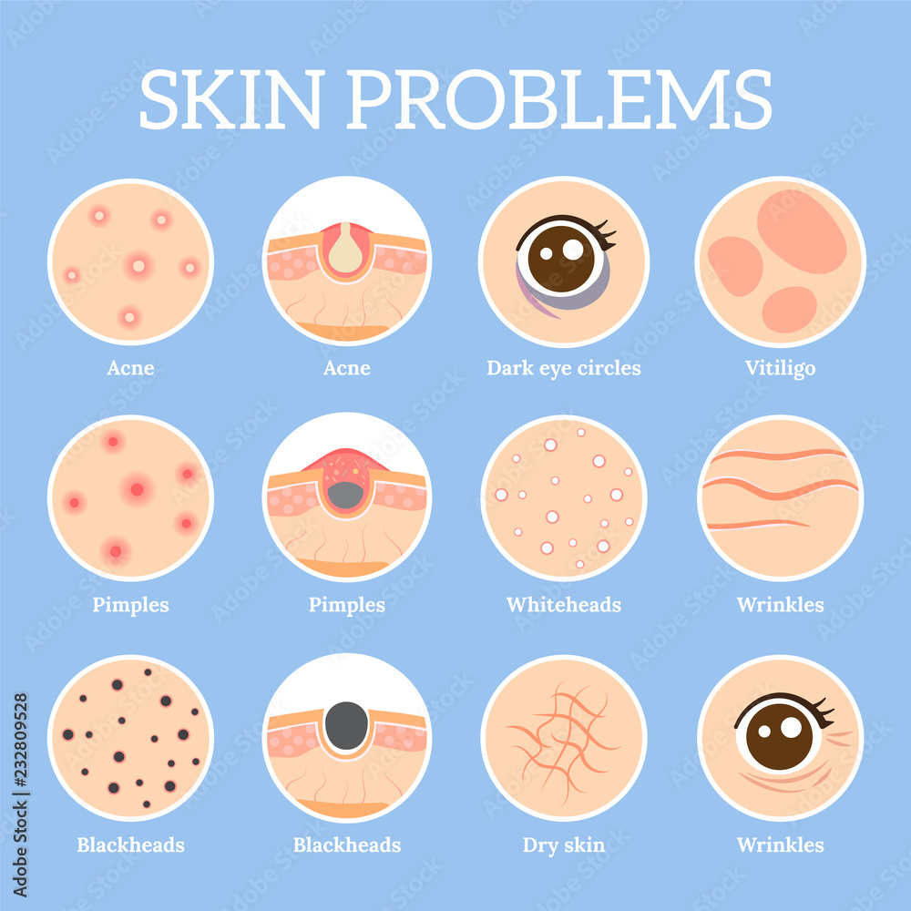 Skin problems. Ages wrinkles problem, face skin infection treatment and ...