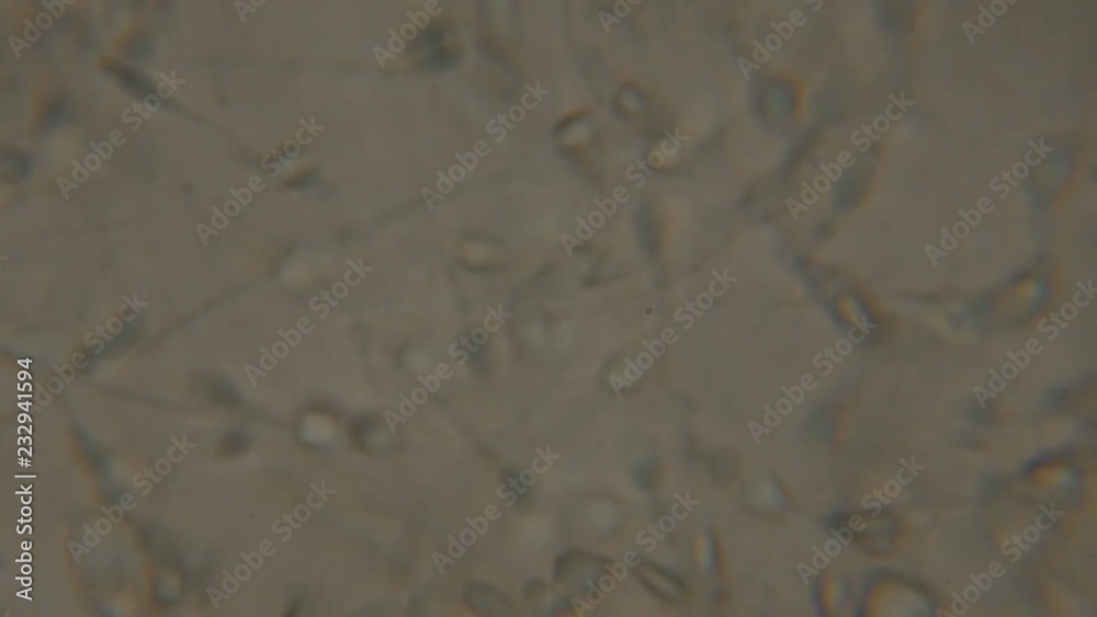 Video „Sperm (spermatozoa) viewed under the microscope. Moving human ...