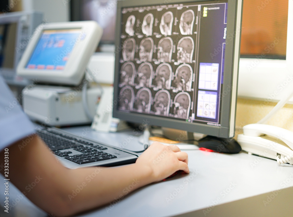 Radiotechnologist hand holding mouse while working on Magnetic ...