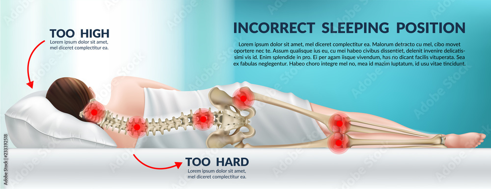 Advertising poster incorrect posture for sleep on a high pillow and ...