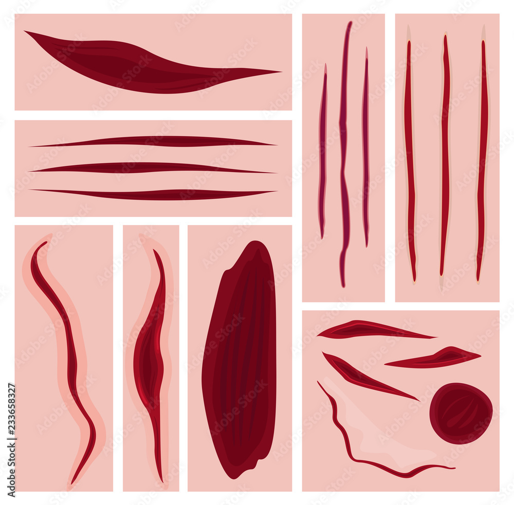 Vector illustration set of cuts, scars, bruises and slaughter. Bloody ...