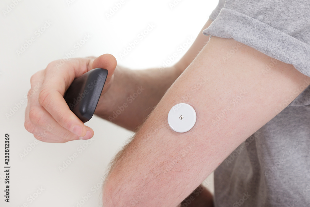 sensor diabetes checkup glucose man system sugar monitoring scan test ...