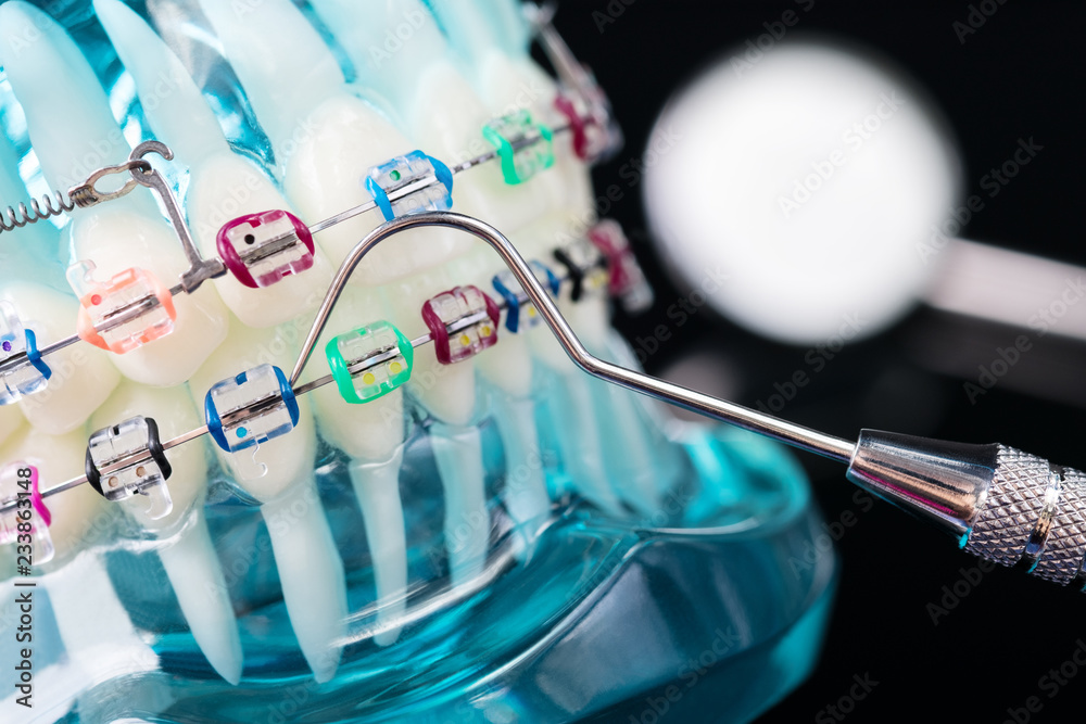 orthodontic model and dentist tool - demonstration teeth model of ...