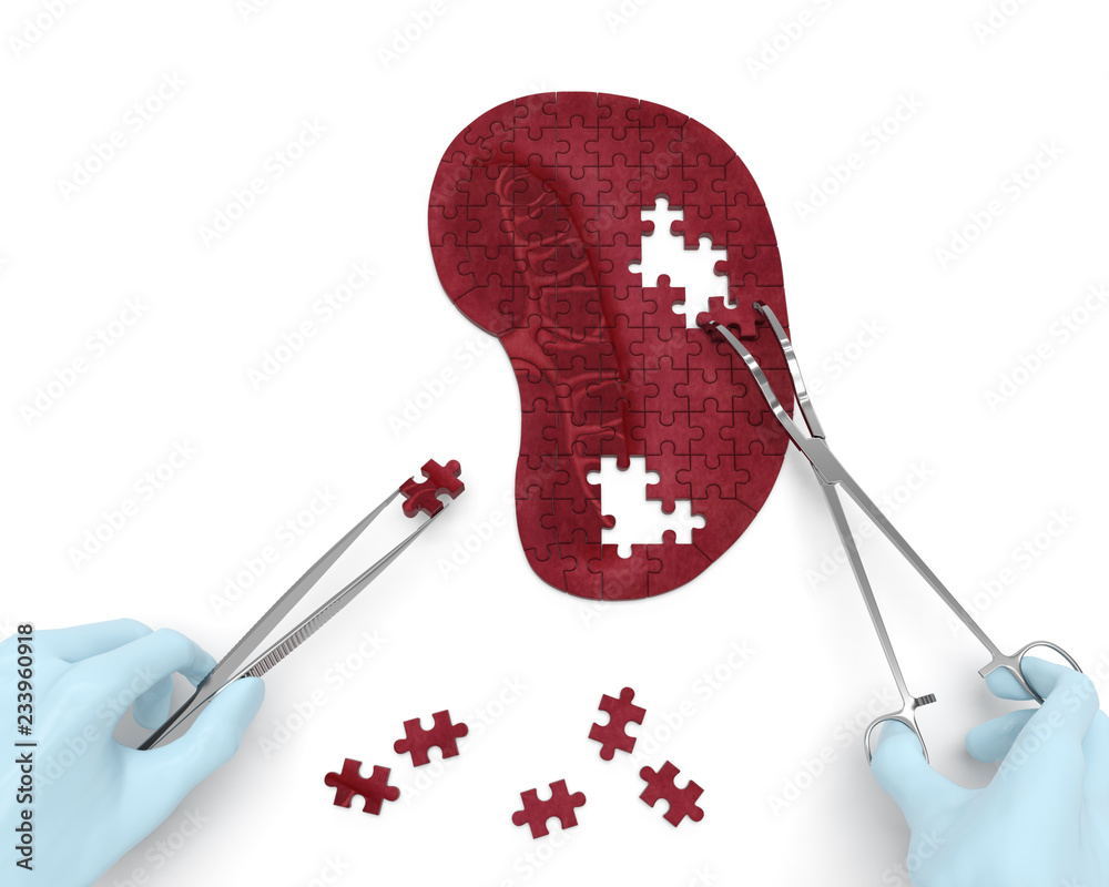 Spleen puzzle concept: hands of surgeon with surgical instruments ...