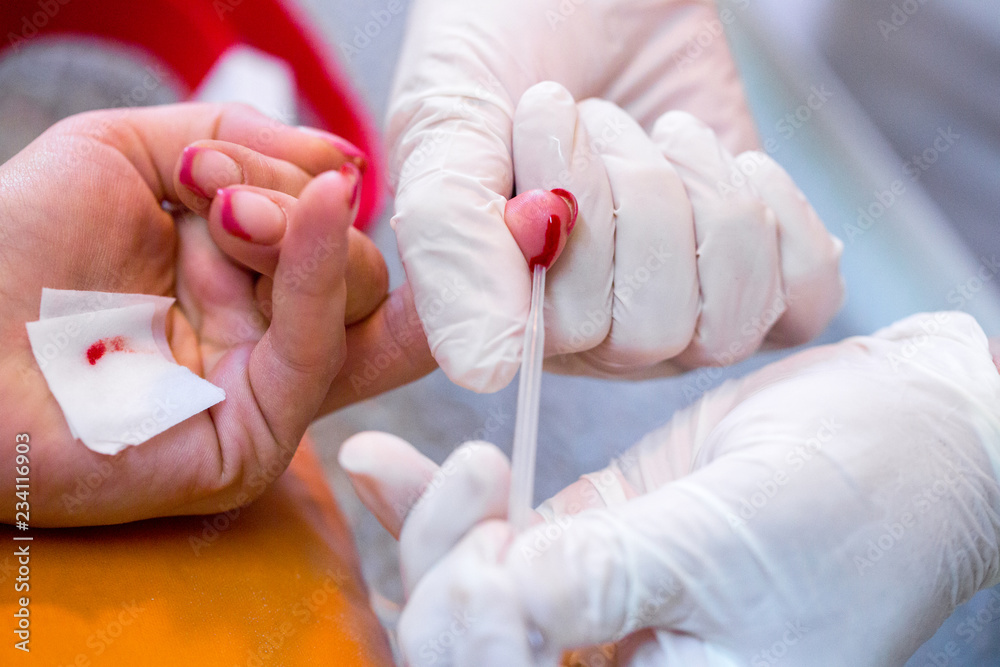 Nurse hands select of dose of blood from a finger woman for rapid ...