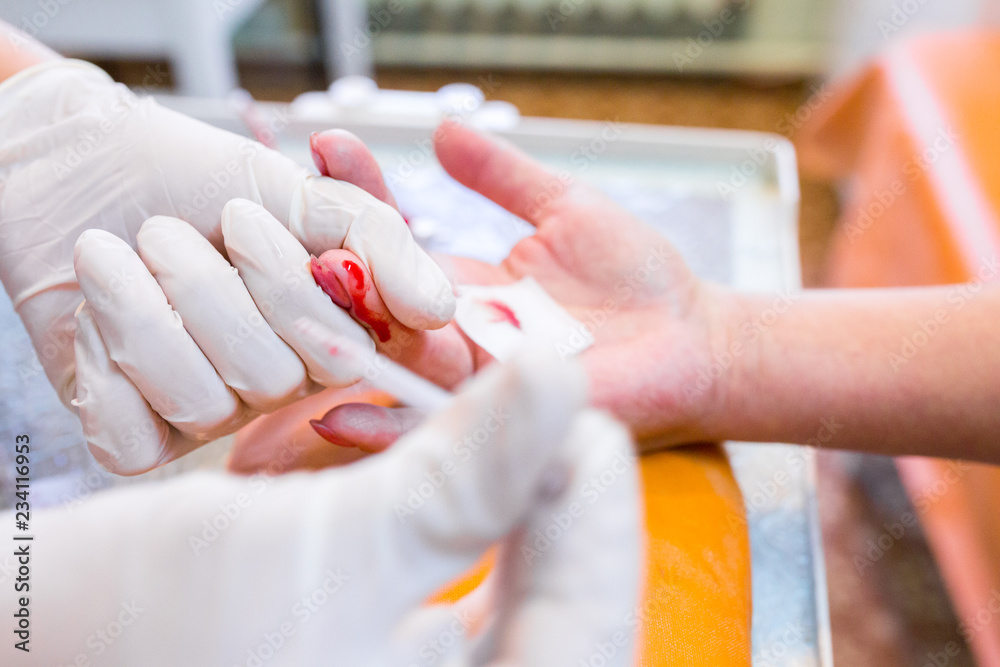 Nurse hands select of dose of blood from a finger woman for rapid ...