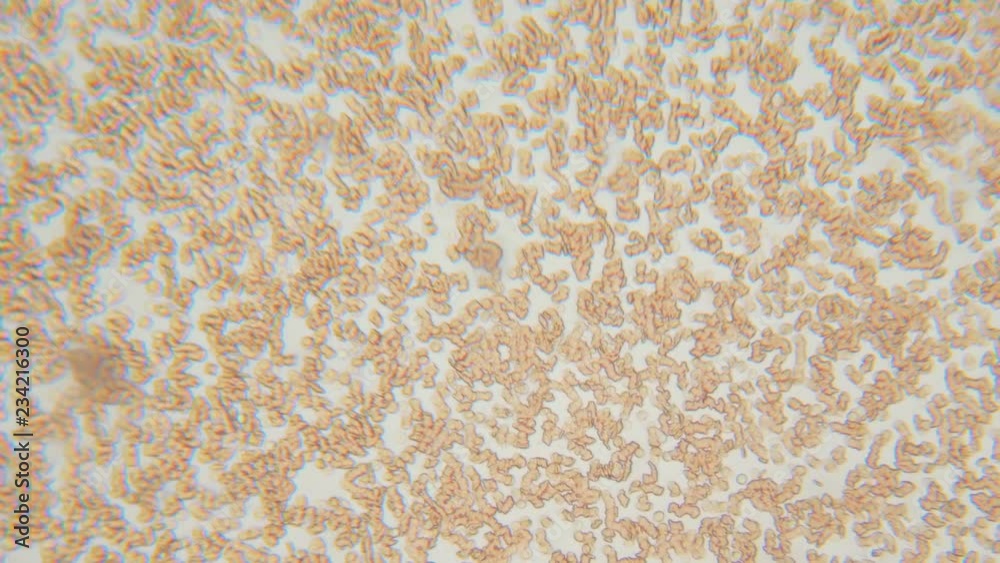 Blood, diseases, interstitial fluid, bacterial background, research ...