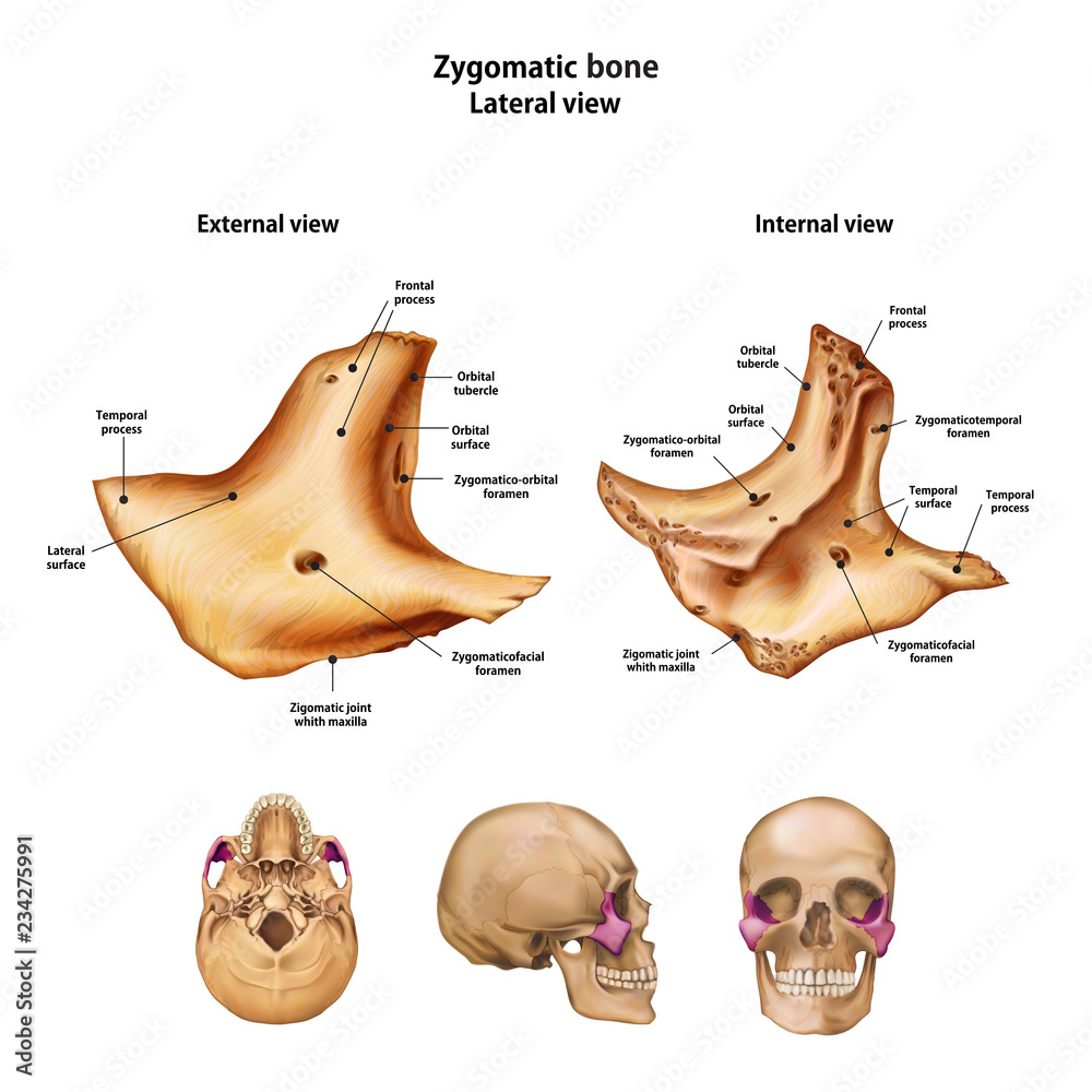 Zygomatic Bone