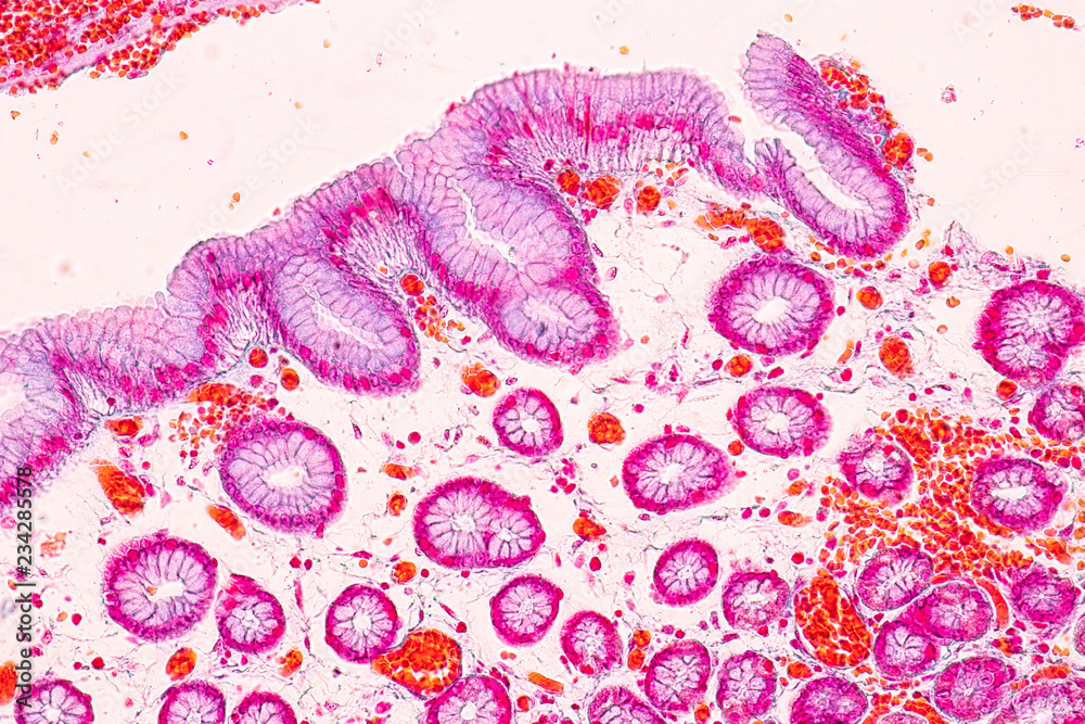 Tissue of Stomach under the microscope for education in Lab. Stock ...