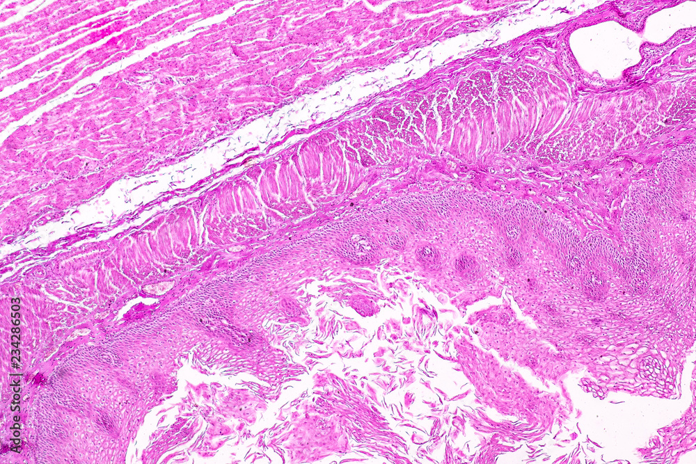 Cross section of the Cerebellum and Nerve human under the microscope ...