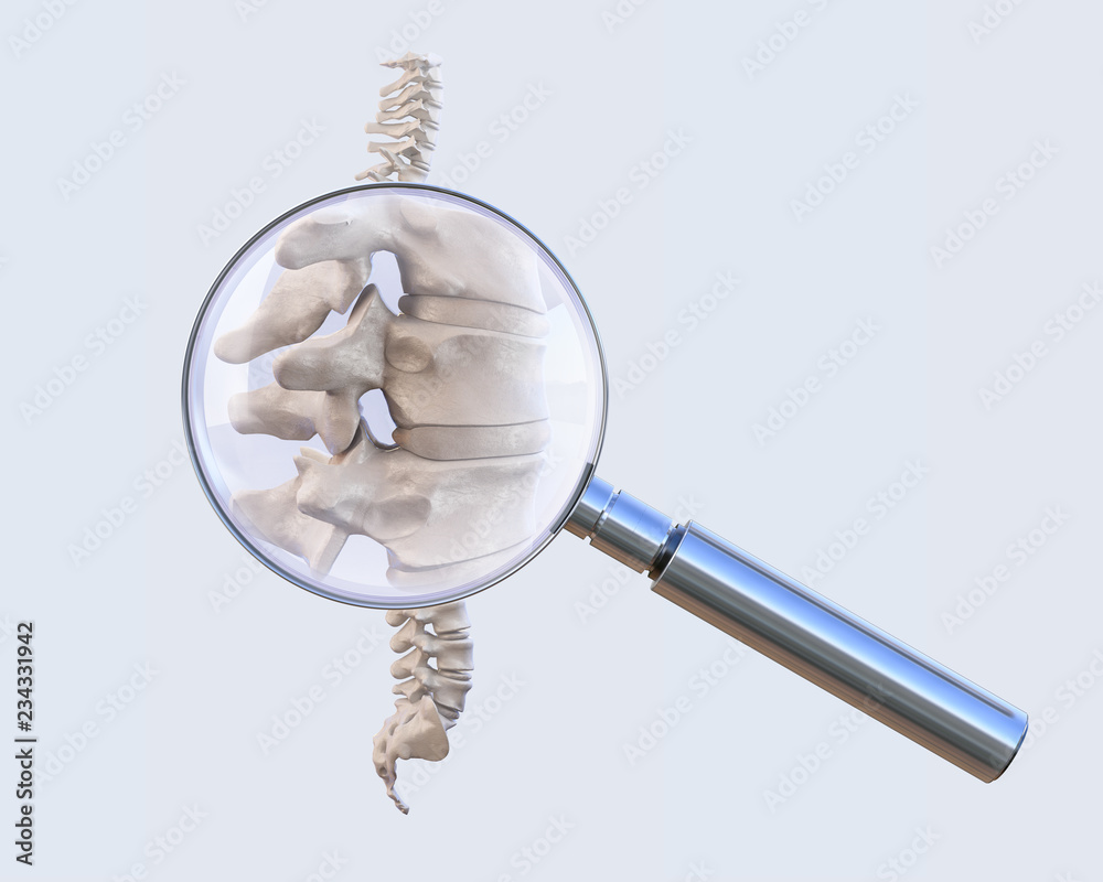 Human spine vertebrae anatomy through magnifying glass. Spine hernia ...