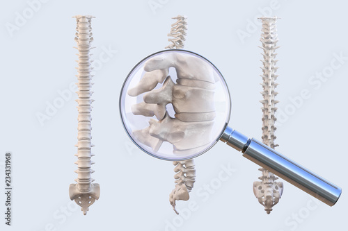 Human spine vertebrae anatomy through magnifying glass. Spine hernia ...