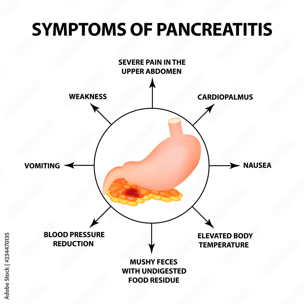 Symptoms of pancreatitis. The structure of the stomach and pancreas ...