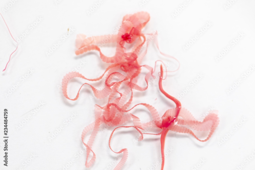 Tapeworm is a freshwater fish parasite under the microscope for ...