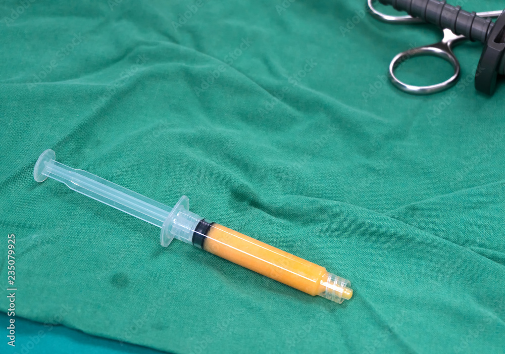 fat syringes on the green surgical drapes for fat grafting or fat ...