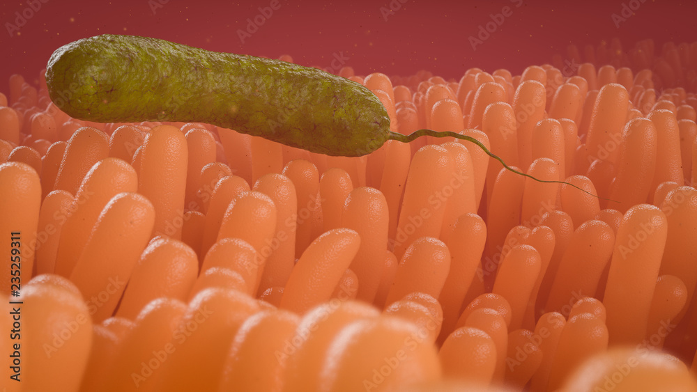 the causative agent of cholera in a small intestine 3d Stock ...