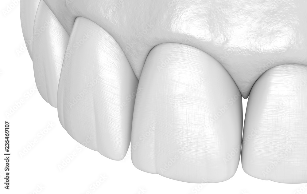 Maxillary human teeth - incisors. Medically accurate tooth 3D ...