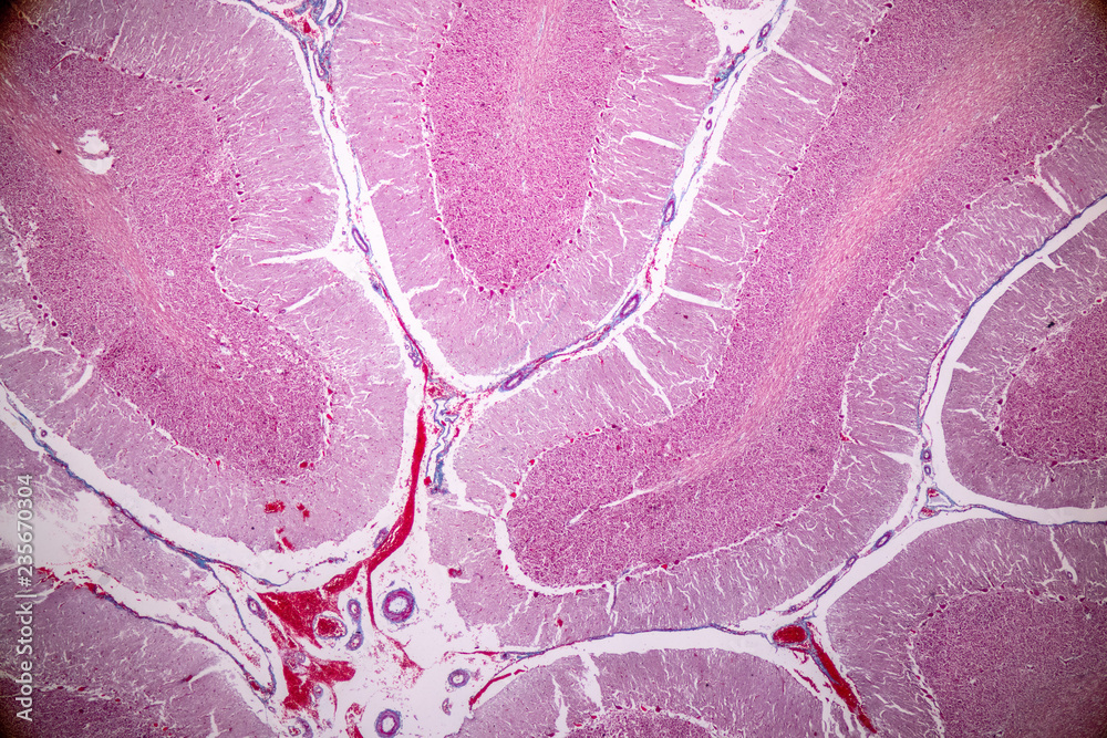 Foto de Cross section of the Cerebellum and Nerve human under the ...