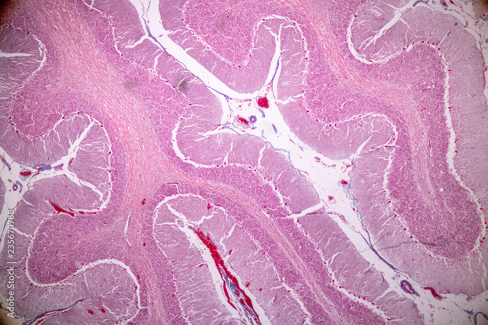 Cross section of the Cerebellum and Nerve human under the microscope ...