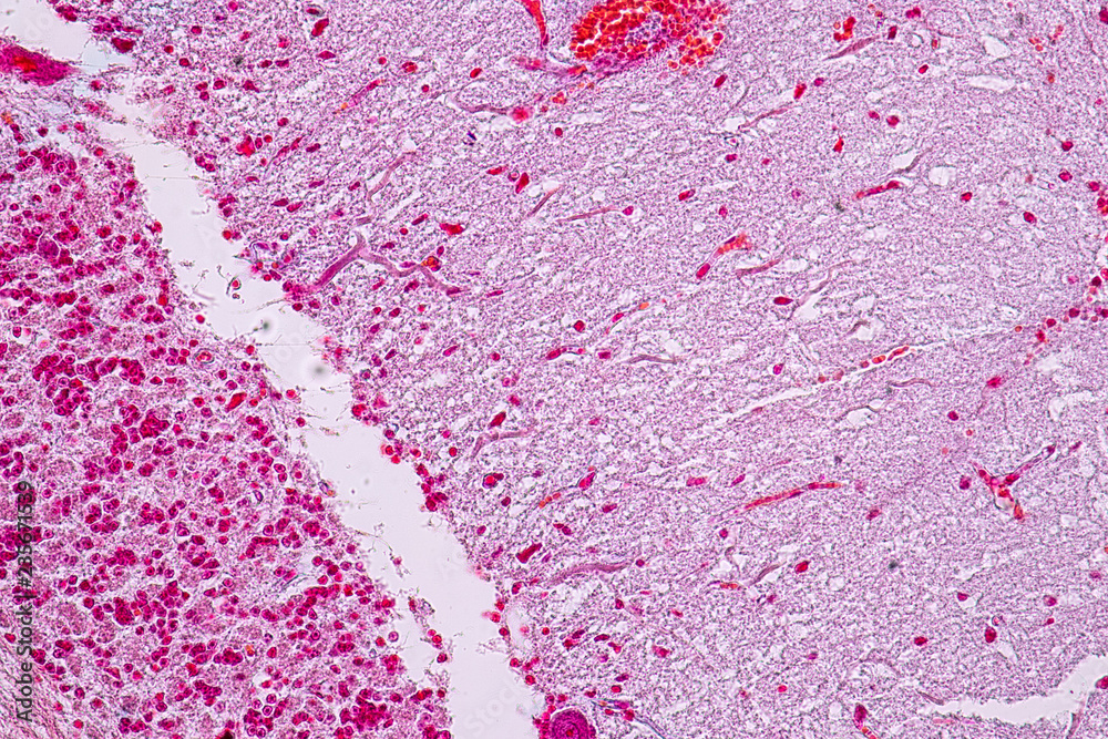 Cross section of the Cerebellum and Nerve human under the microscope ...