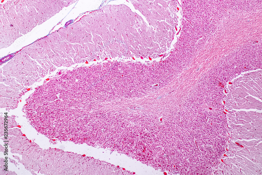 Cross section of the Cerebellum and Nerve human under the microscope ...