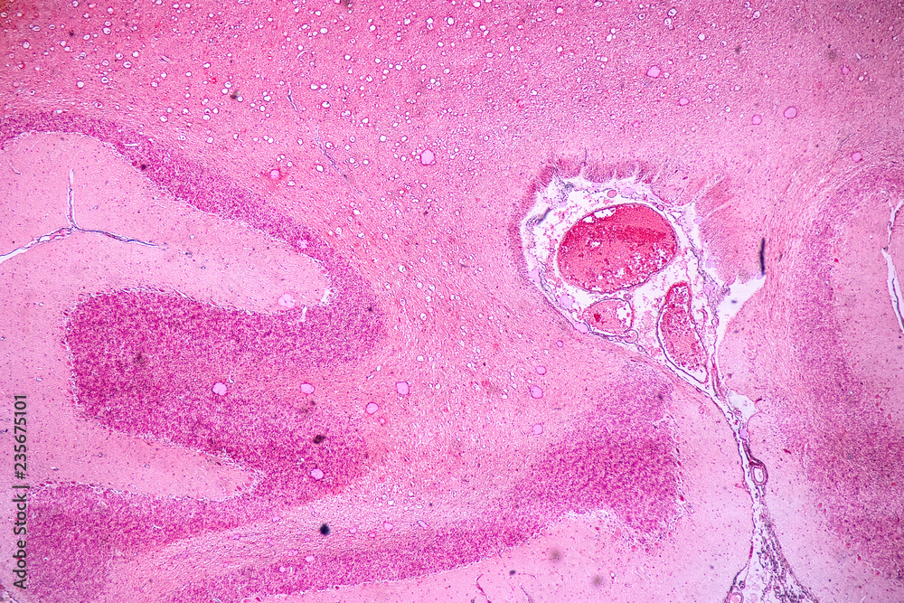 Cross section of the Cerebellum and Nerve human under the microscope ...