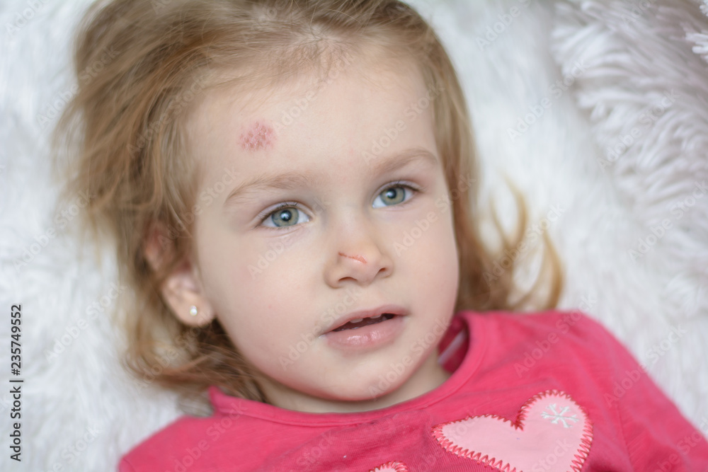 Physical injury blood wound skin child pain, Inflicted on the child's ...
