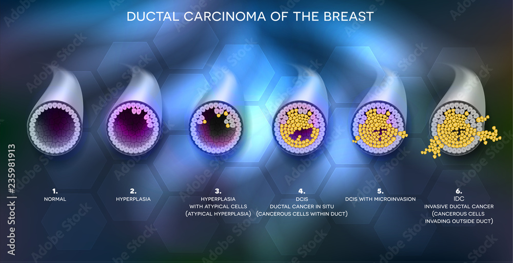 Ductal Cells