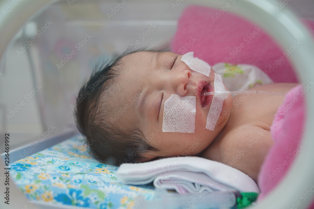 Newborn baby having the the breathing problem after birth. and the ...