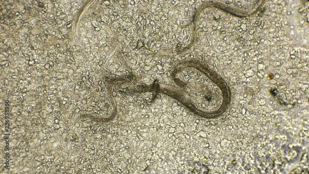 nematode worm colony, which is used to feed fish fry, under a ...