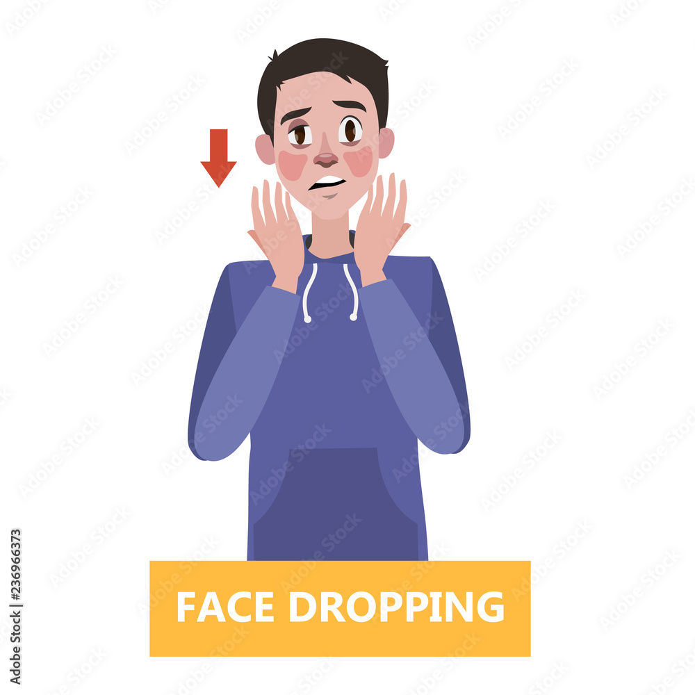 Sign of a stroke infographic. Man with face drooping Stock Vector ...