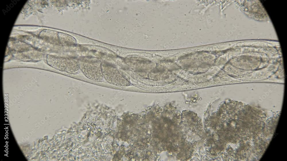 young nematodes inside the female acetic eel Turbatrix aceti, which are ...