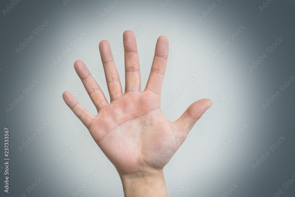 hand with six fingers, human mutation, not like everyone else, strange ...