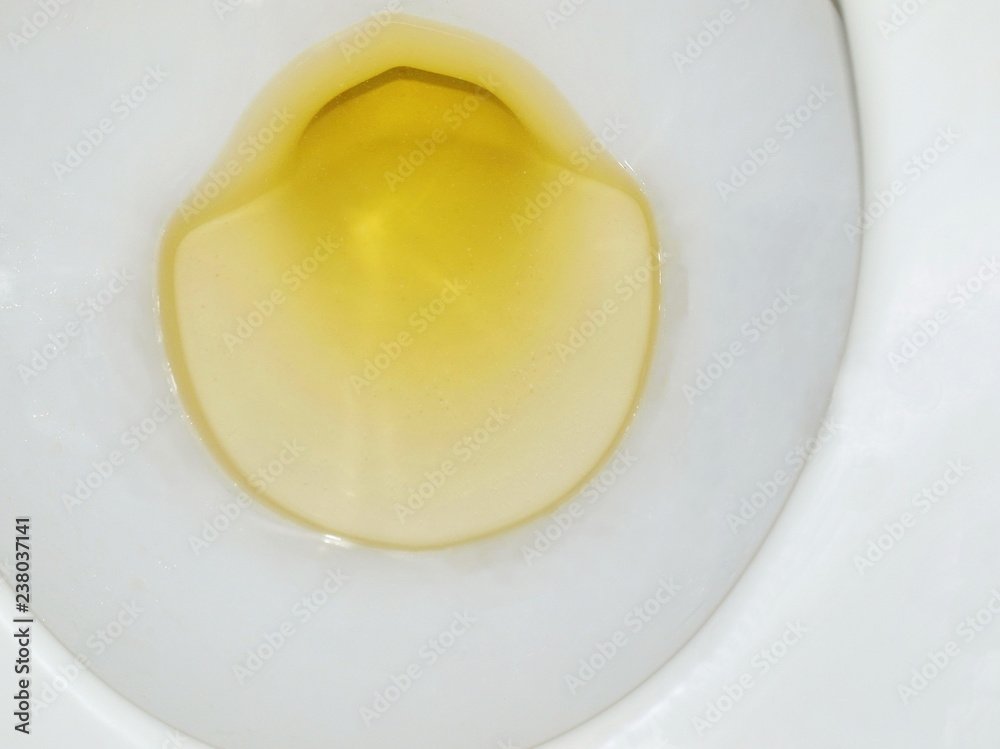 Closeup Urine Or Yellow Pee In White Flush Bowl Toilet In Restroomtoilet Bowl Full Of Urine