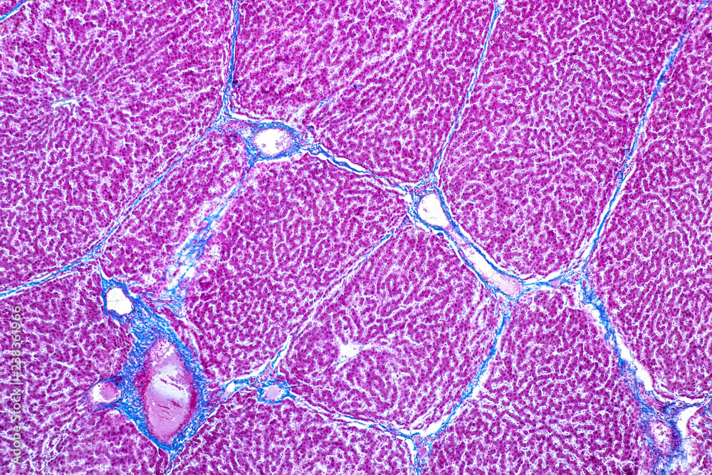 Tissue of Liver under the microscope for education in Laboratory ...