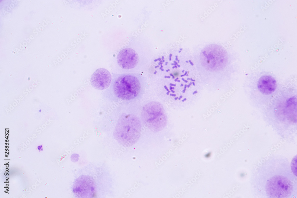 Chromosomes Human under the microscope for education. Stock Photo ...