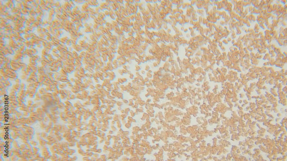 Blood, diseases, interstitial fluid, bacterial background, research ...