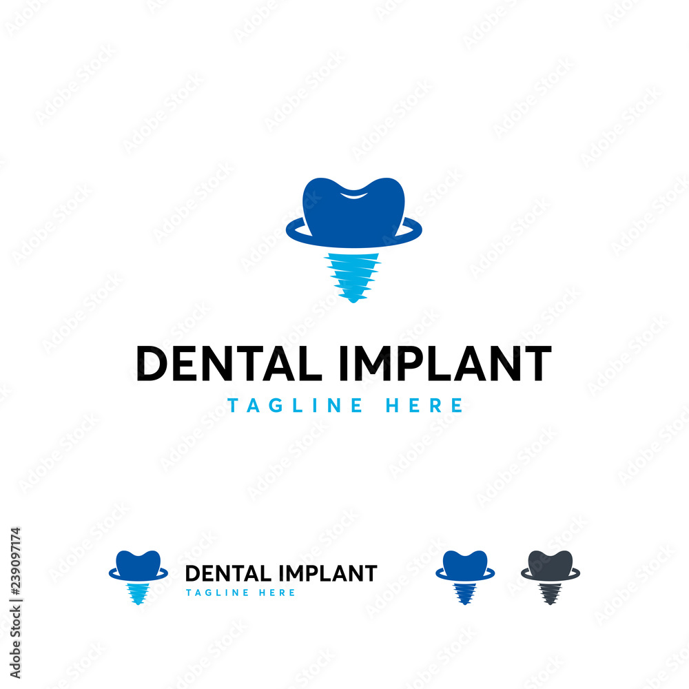 Dental Implant logo designs concept template, Dental Logo concept ...