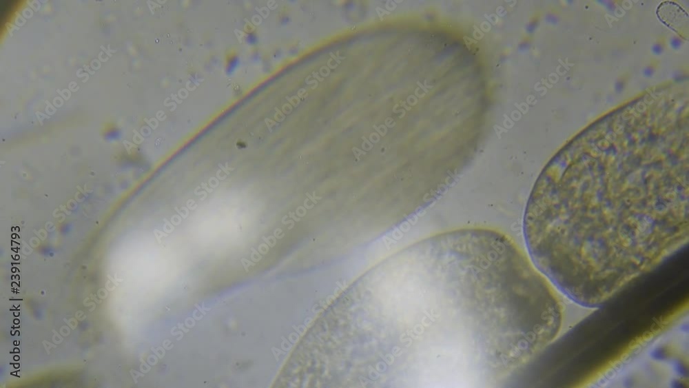 Microscope image footage of protozoa microorganisms in water, showing ...