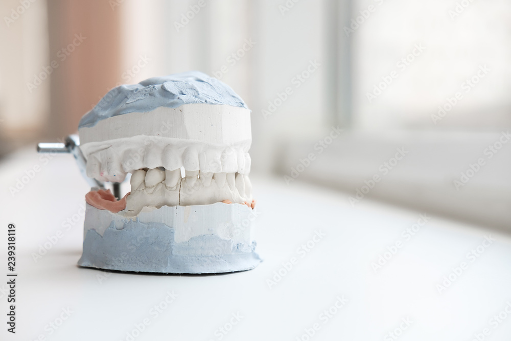 Plaster Cast of jaws. Dental casting gypsum model human Jaws in ...